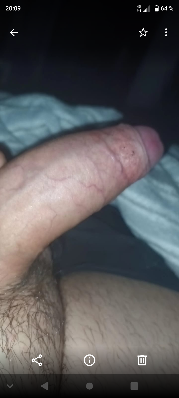 Algunas De Mi Polla 3 Pics Xhamster