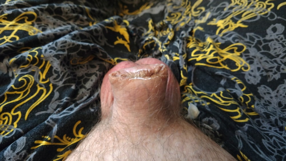 Super Glue Fun 24 Pics Xhamster 7594